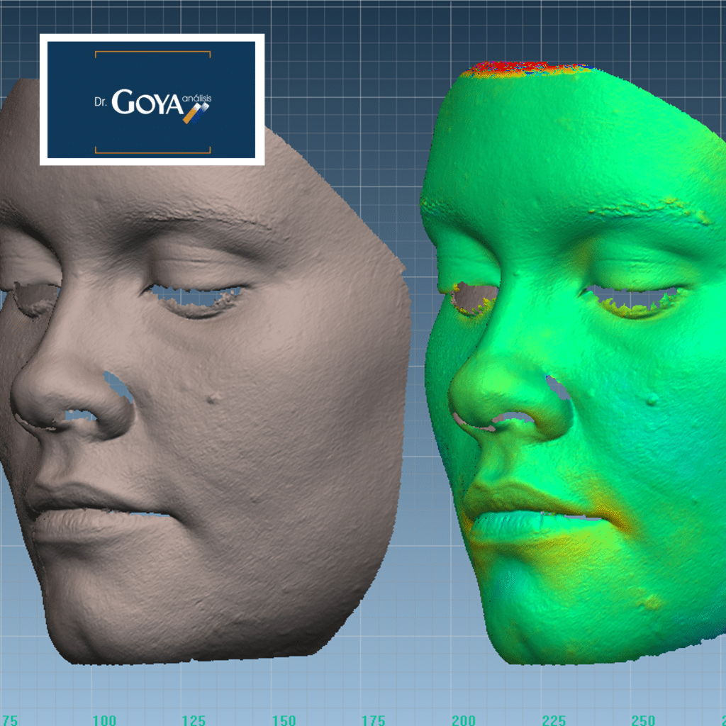 The future of cosmetics: the power of 3D image analysis in efficacy ...