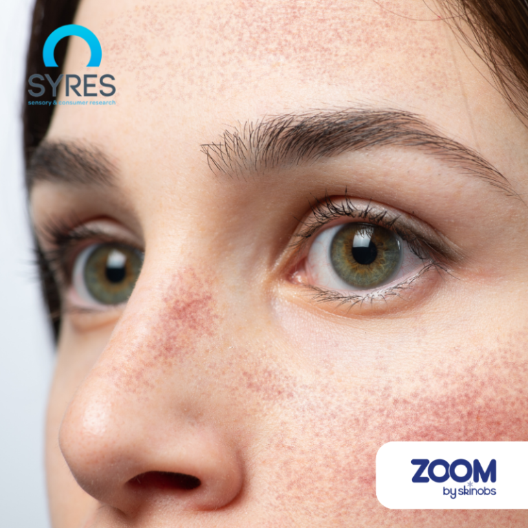 Analysis of skin sensitivity in french panel by Syres via ZOOM#34 ...